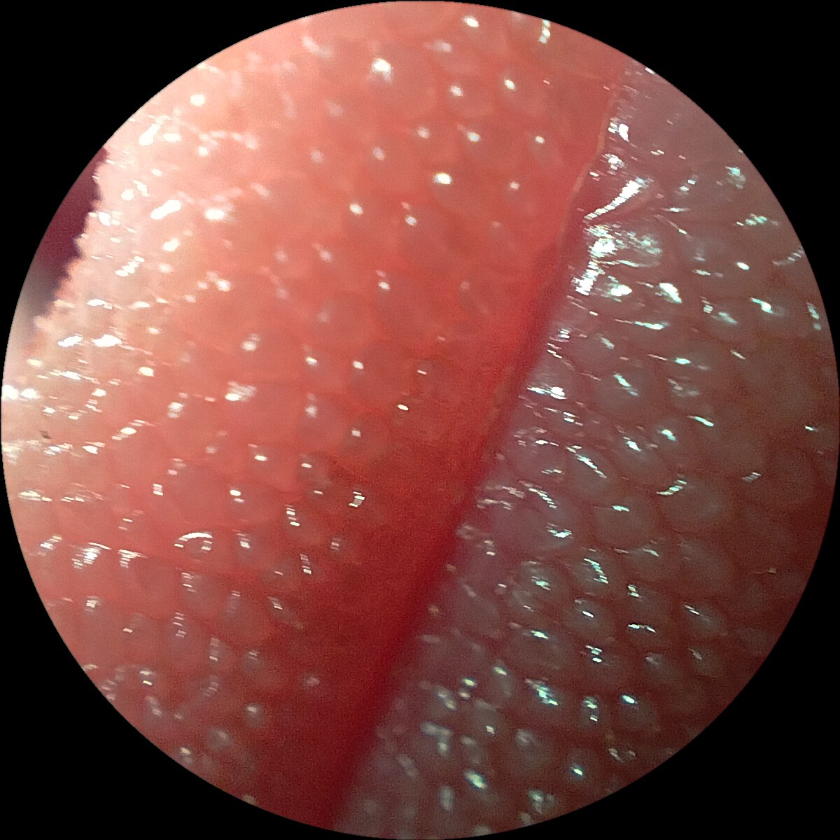 Picture Of My Cat's Nose Under the microscope of Oppo A98, N