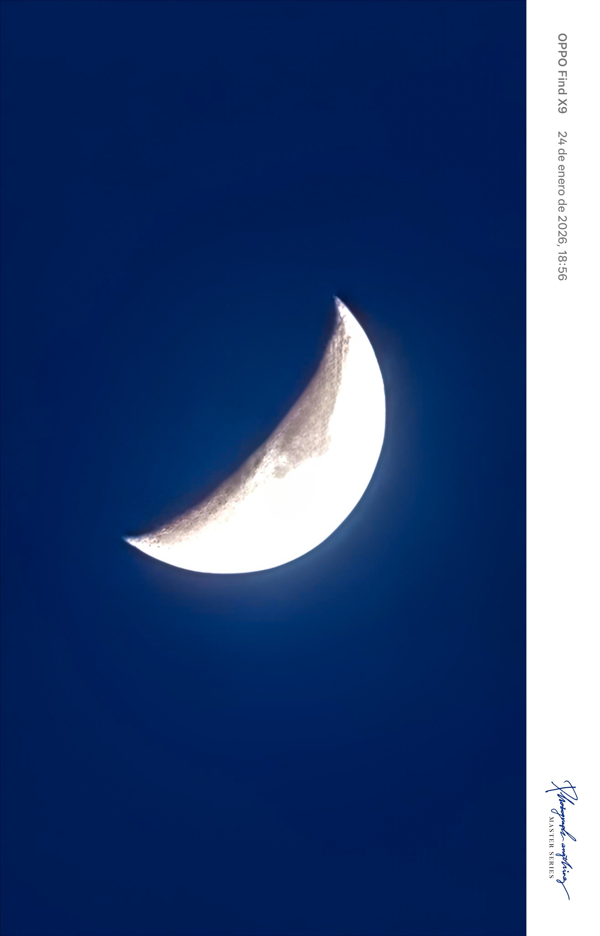 Zoom in Love 📸👀 Every Detail, Maxed Out!